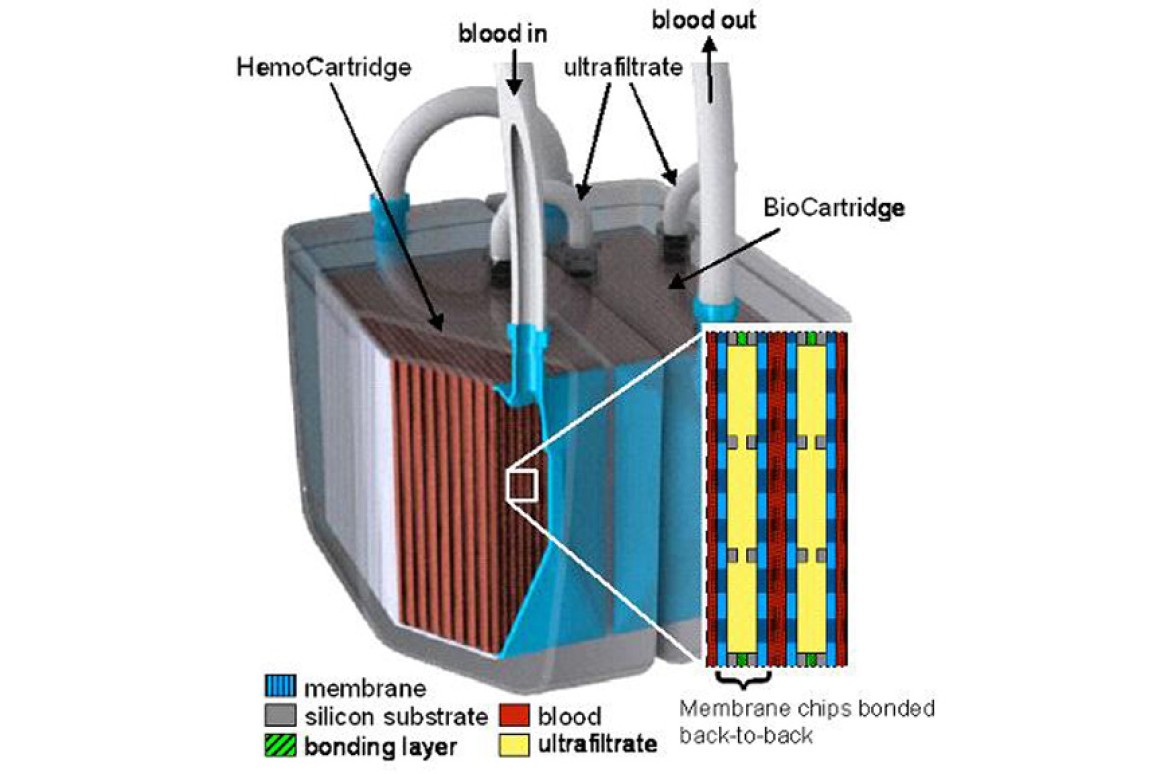 Artificial Kidney: How To Build It And Its Benefits | Robots.net